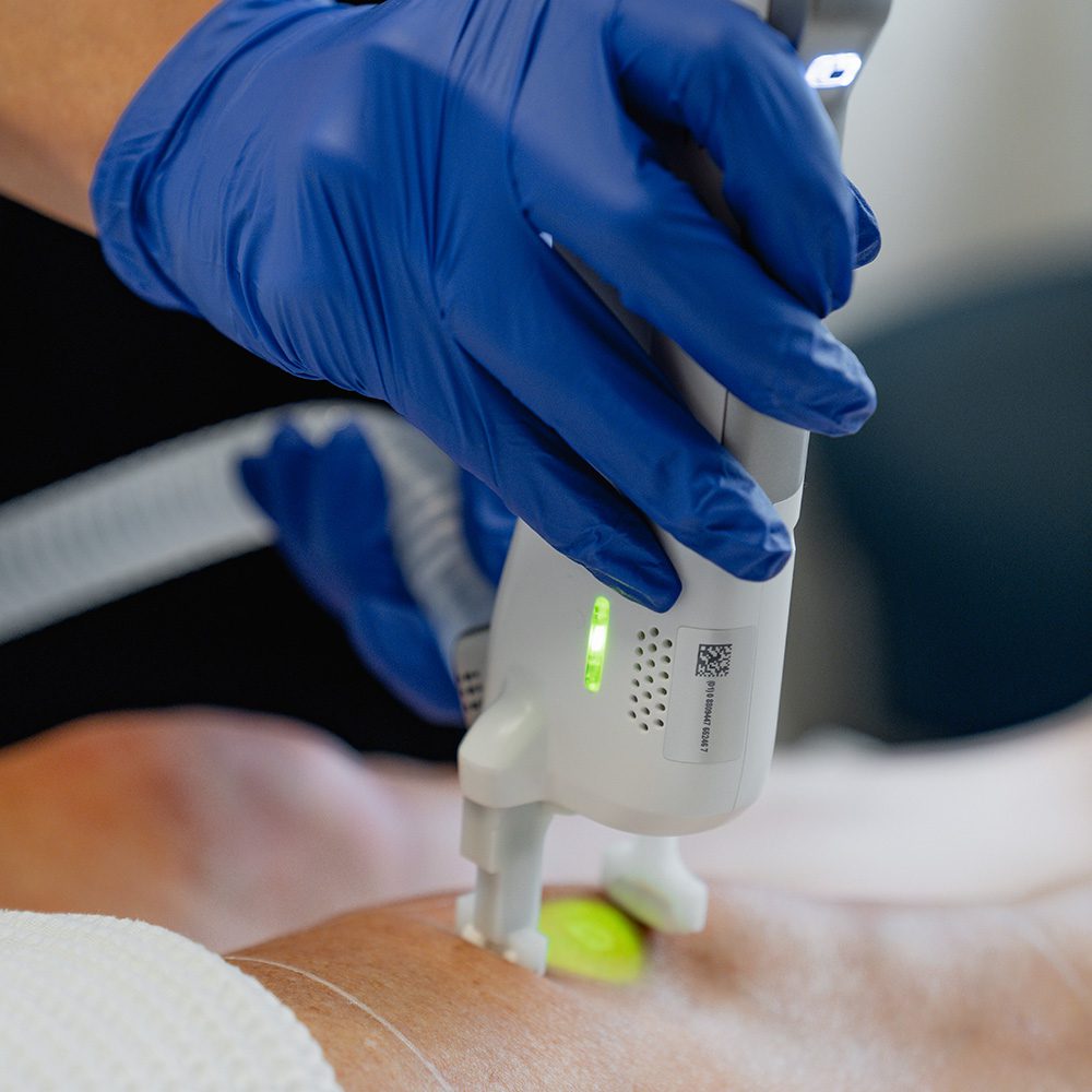 Laser Hair Reduction in Kalispell | Laser Cosmetic Center